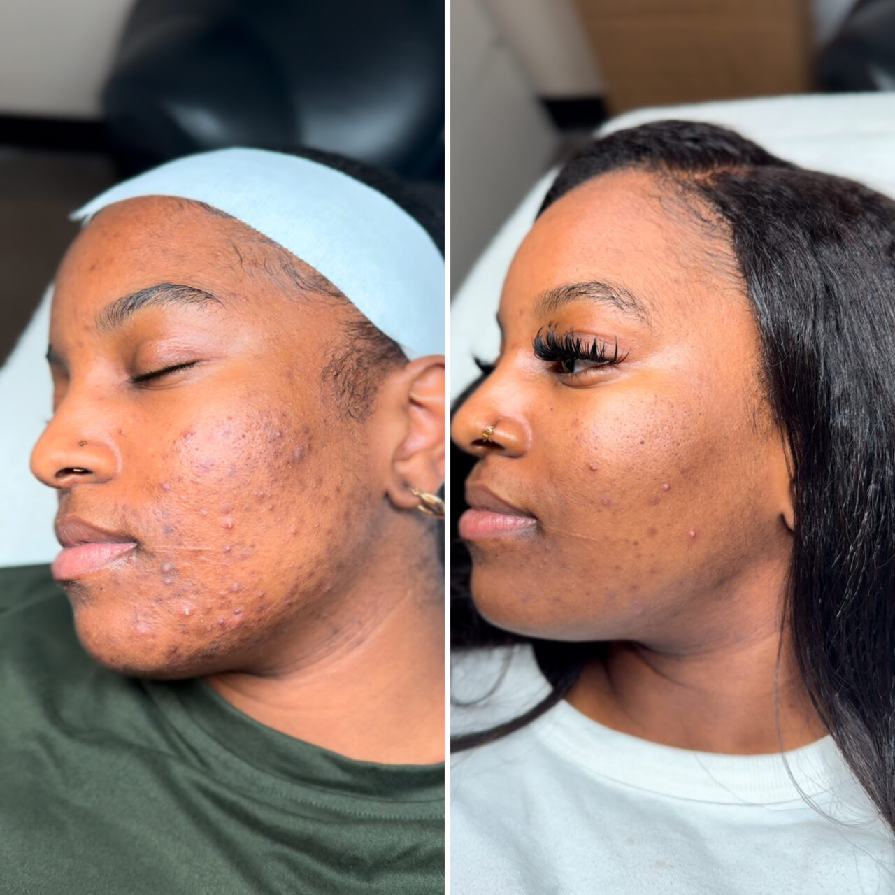 Dallas Pro Aesthetics